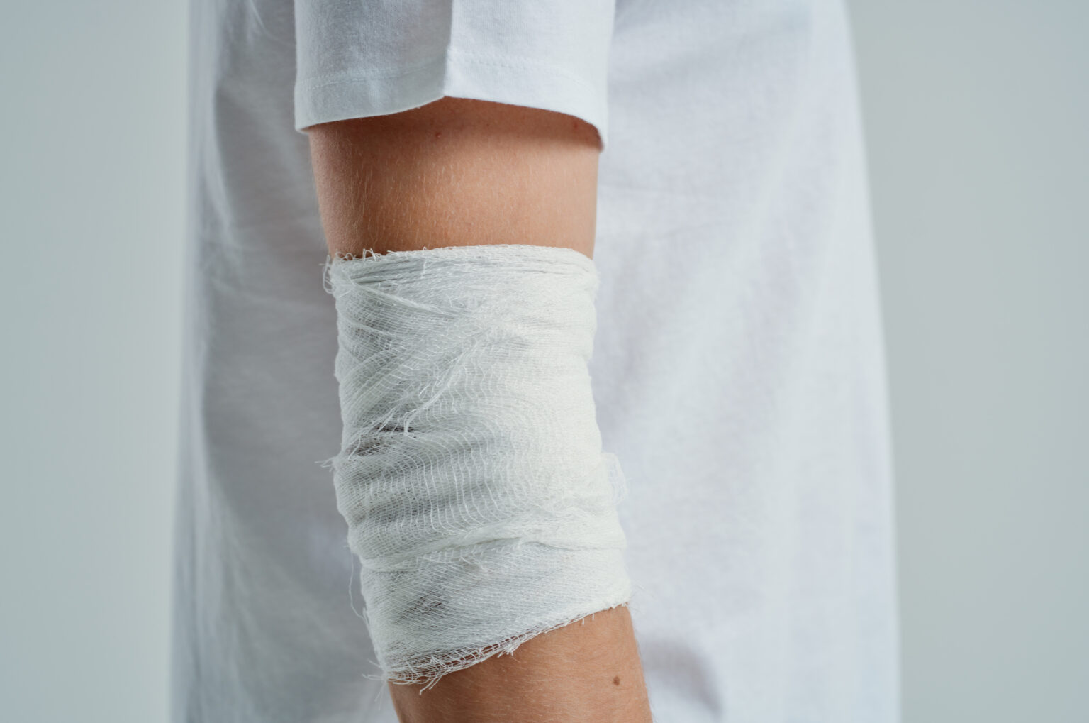 Third Degree Burn Injury Claims in San Francisco | Severe Fire Injuries